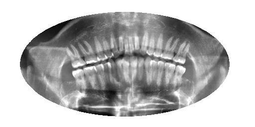 Dentalai I4clz Fsod Fsuo Object Detection Dataset V1 2025 03 12 4