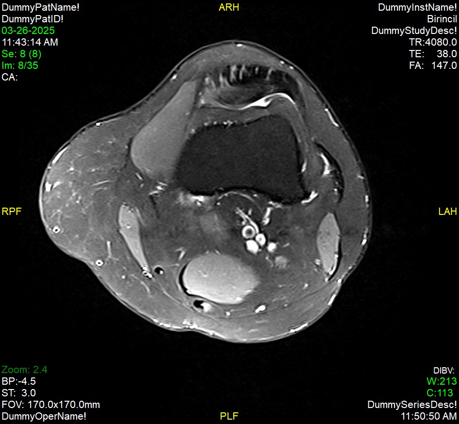 sağlıklı Instance Segmentation Dataset by deep learning work