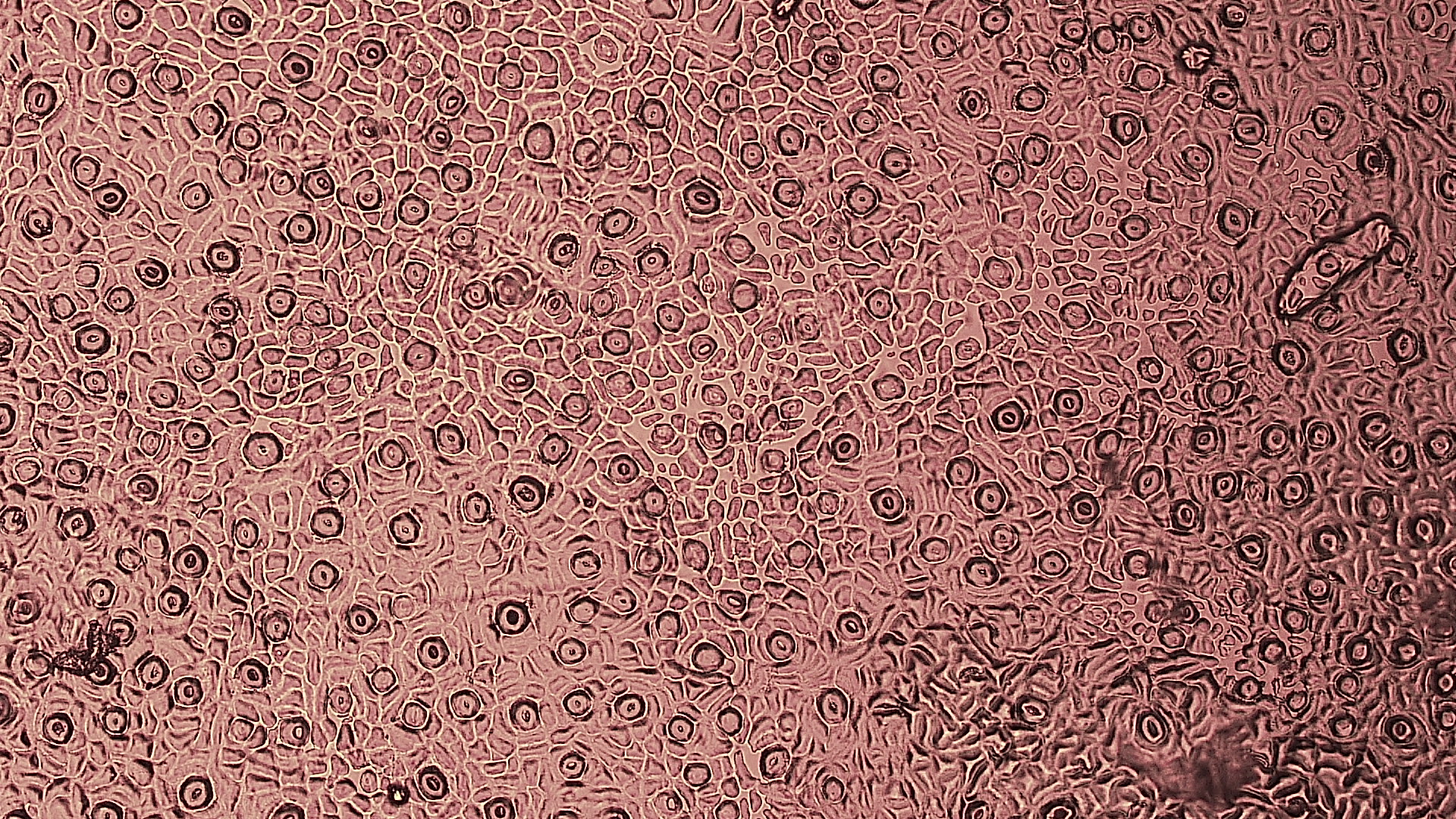 Stomacounter Object Detection Model By Stomata Counter