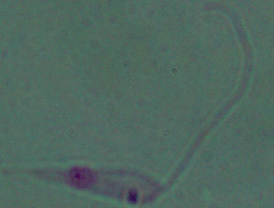 Parasites Object Detection Dataset and Pre-Trained Model by MilanELEC04223