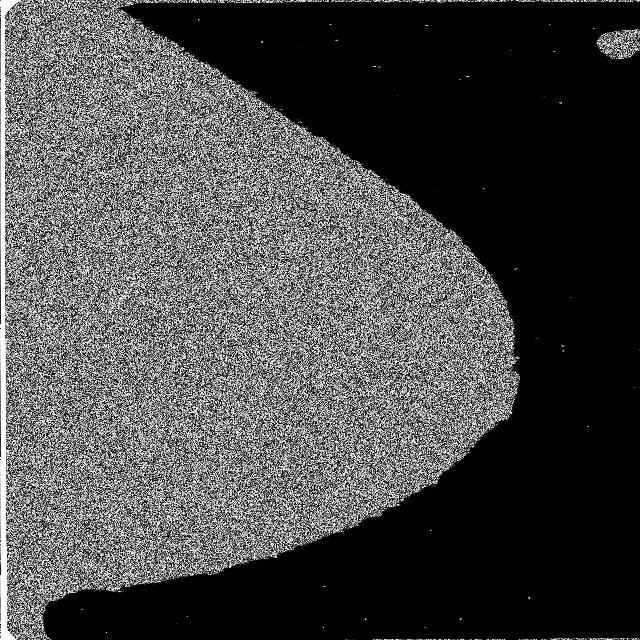 breast_cancer_detection Object Detection Dataset by Kajal