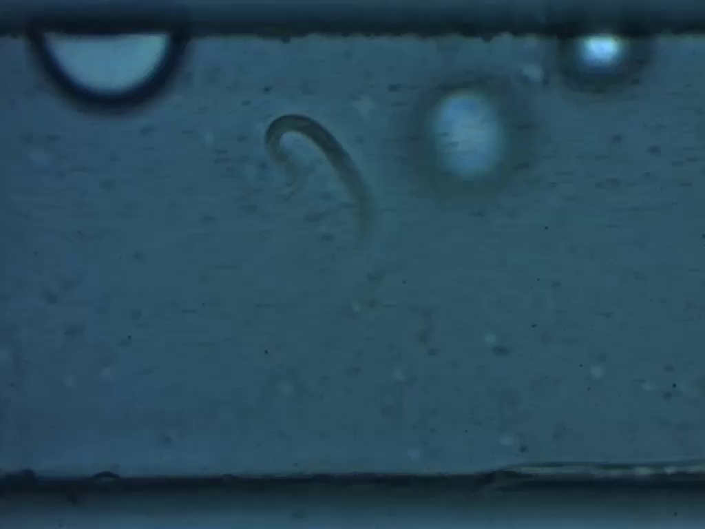 Worm Detection Project Object Detection Model by Project