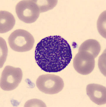 Blood cell labeling using YOLO v7 Classification Dataset and Pre ...