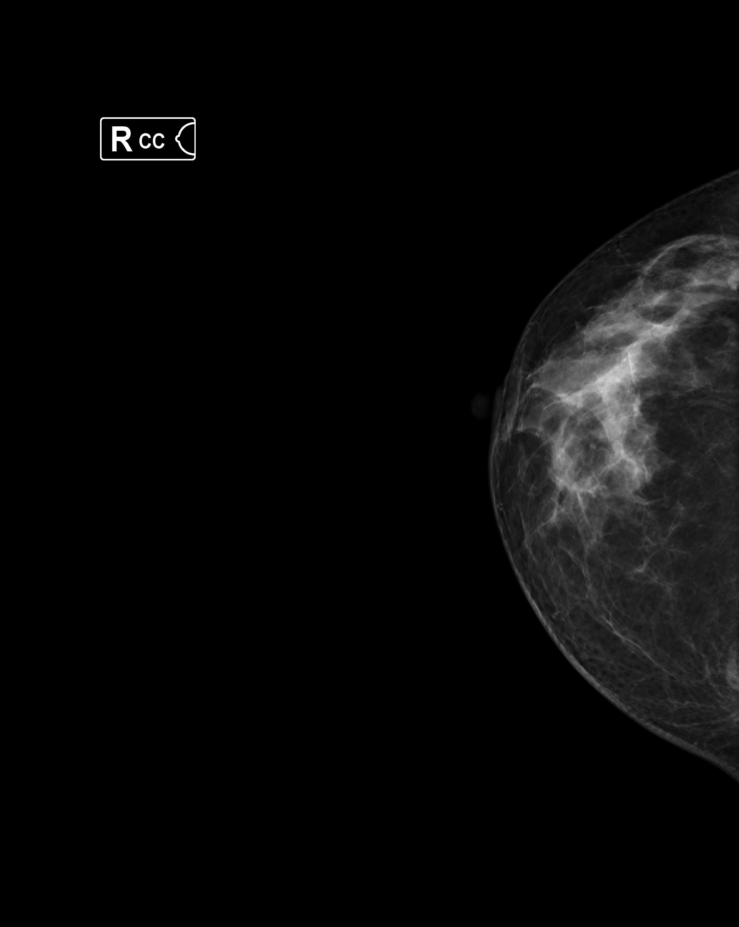 calc Object Detection Dataset by tt