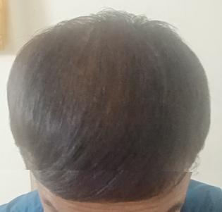 Hexa Classification Dataset by Mohit Srivastava