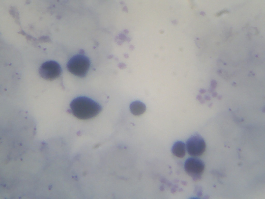 malaria-pathogen-2 Object Detection Dataset by Anand Koirala