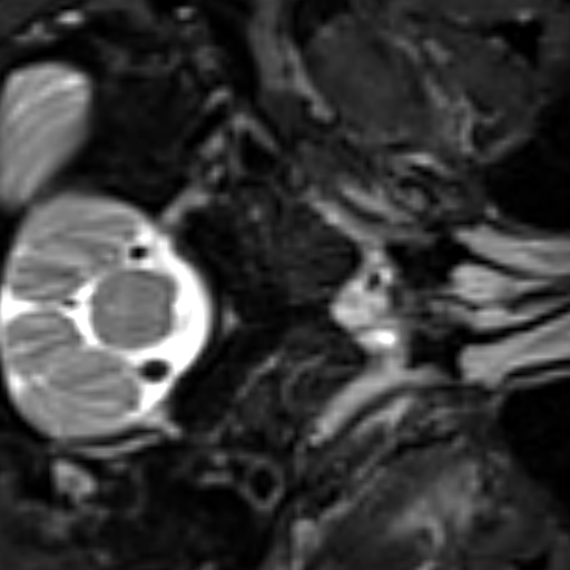 MRI_CBCT_fusion Instance Segmentation Model by Matthias Moeskes