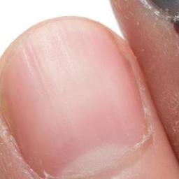 nail Object Detection Dataset by research