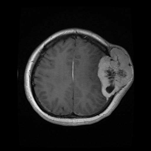 Brain MRI segmentation Instance Segmentation Dataset by Ammar Ali