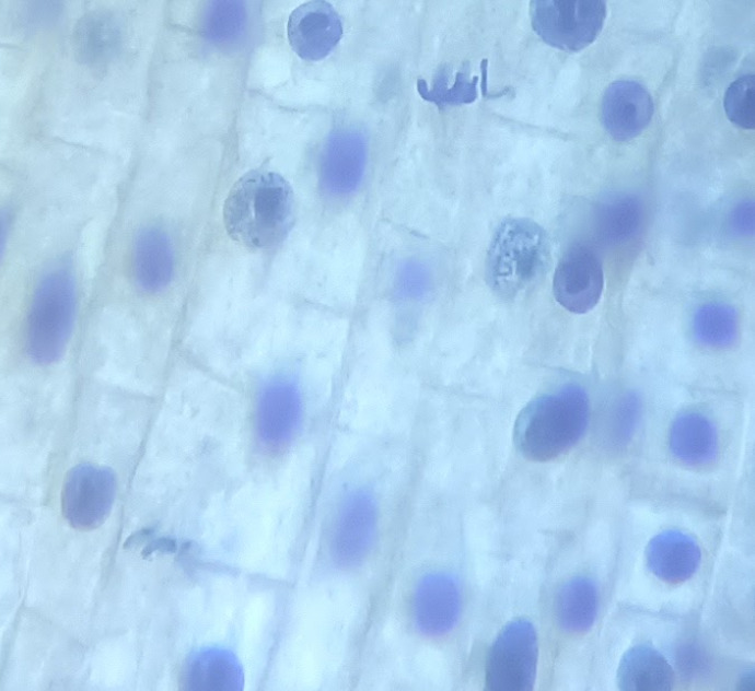 Sample Image Augmentation Object Detection Dataset And Pre Trained Model By Tori