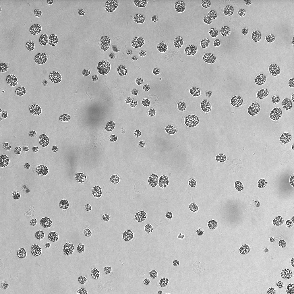 Microalgae-KOVA Object Detection Dataset by Segmentationcells