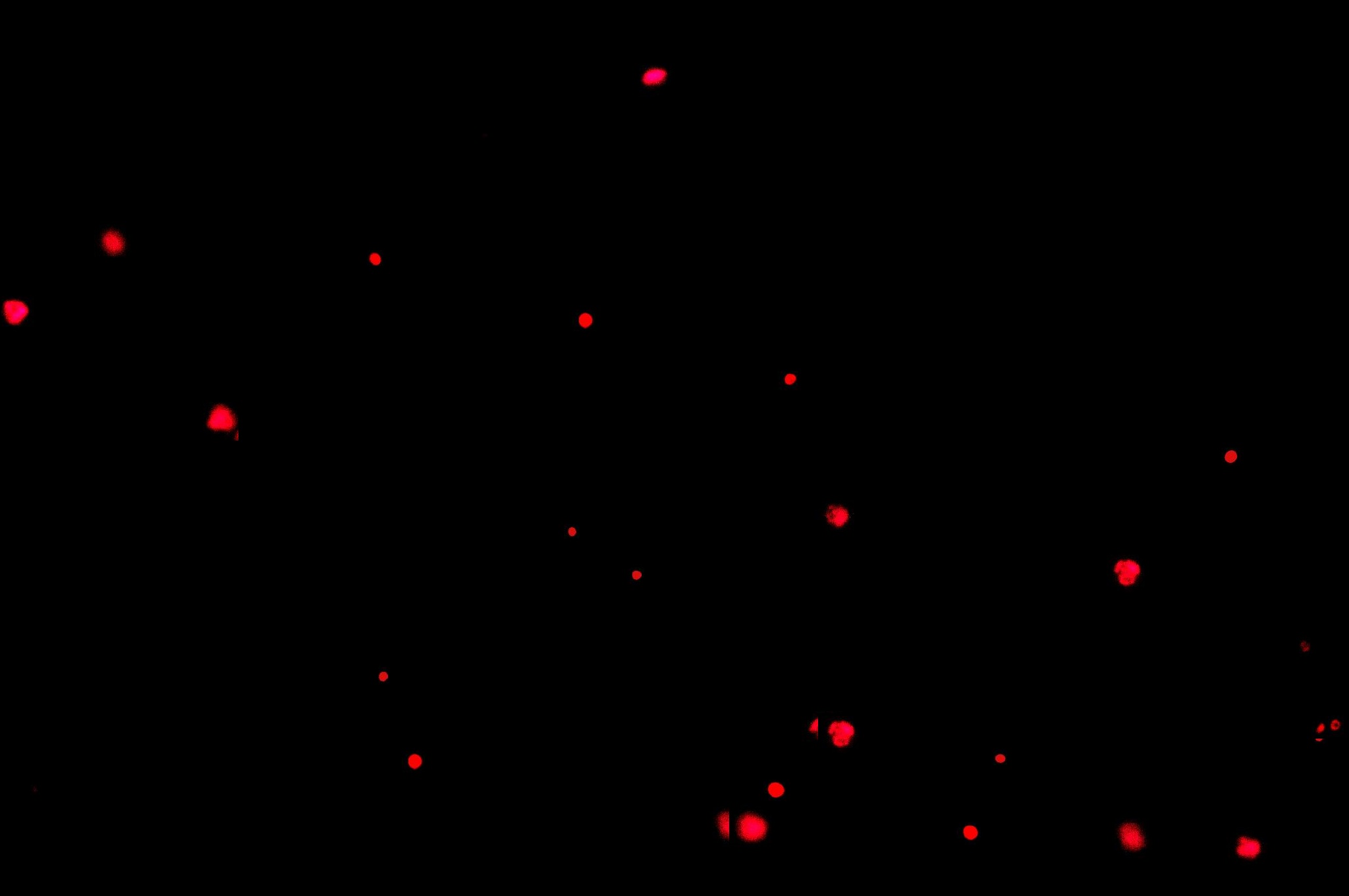 µalgae Augmented Dataset Object Detection Dataset By Segmentationcells