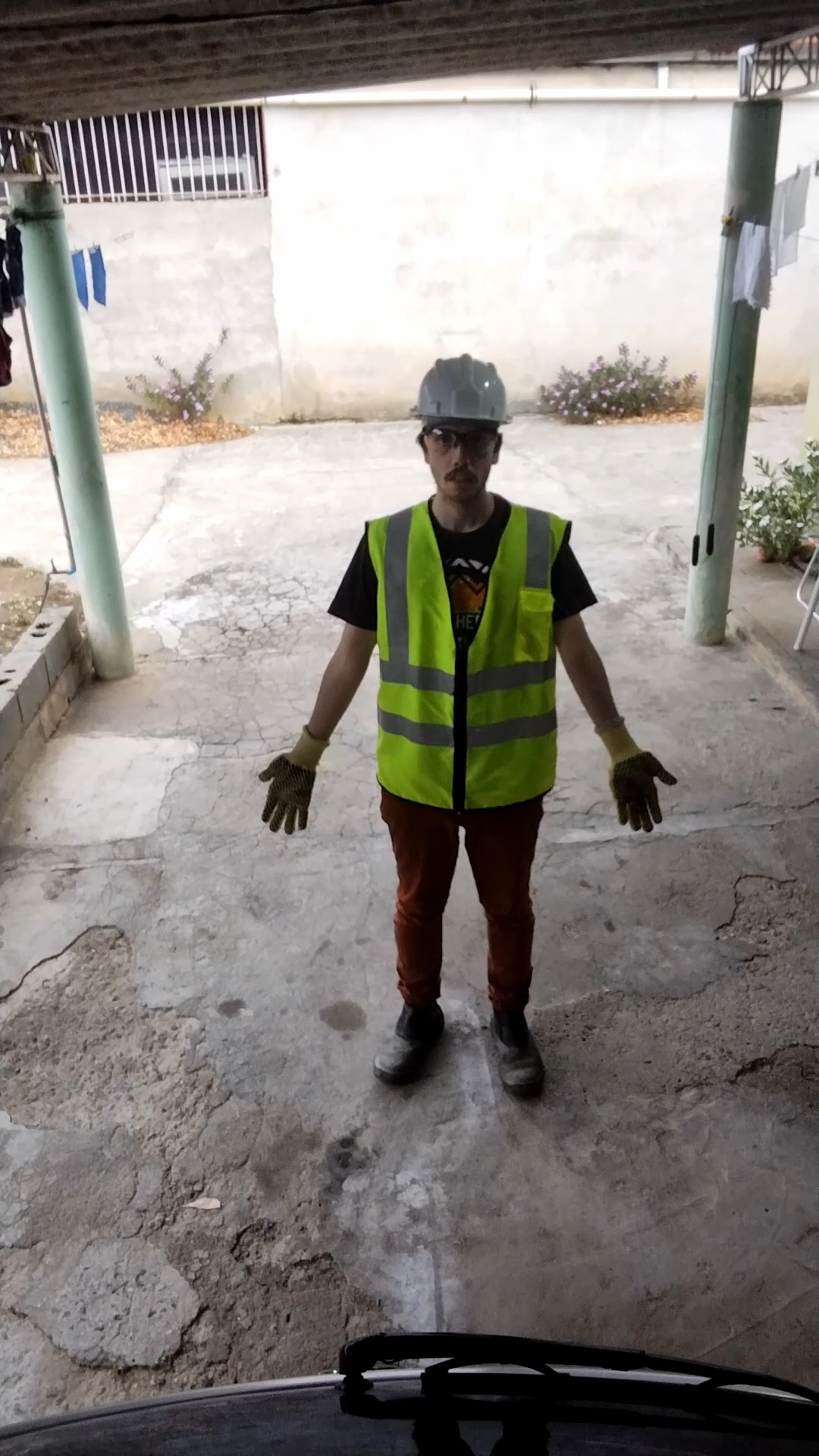 EPI detection Instance Segmentation Dataset and Pre-Trained Model by TC Project