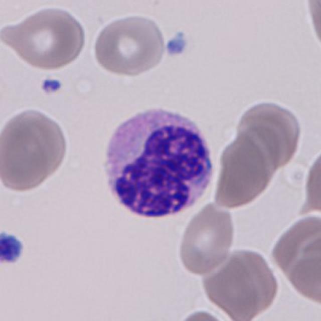 BCCD Object Detection Dataset by models