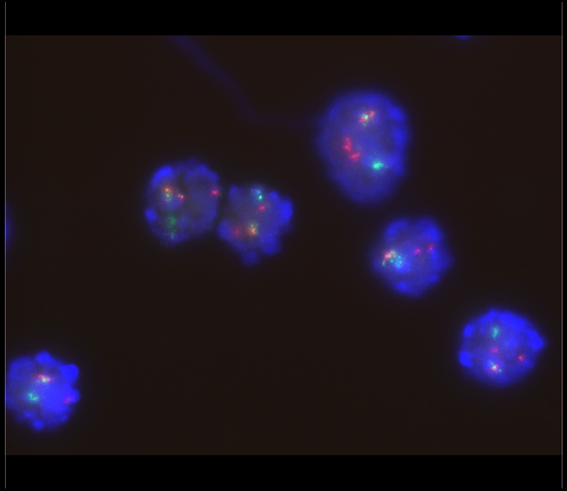 FISH fusion 2025-01-10 Instance Segmentation Dataset and Pre-Trained Model by Breast Cancer ...