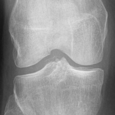 Knee_Train_2 Semantic Segmentation Dataset by College Detection Project