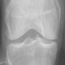 Knee_Train_0 Semantic Segmentation Dataset by College Detection Project