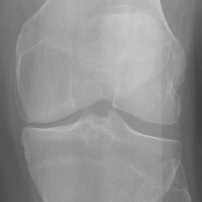 Knee_Train_3 Semantic Segmentation Dataset by College Detection Project