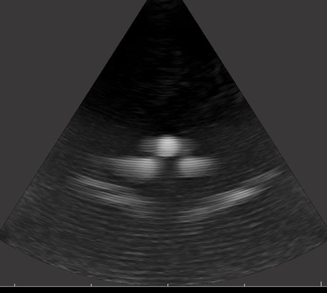 Holes Object Detection Dataset by Alex