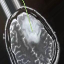 How to Use the Scalpel MRI Images Instance Segmentation API