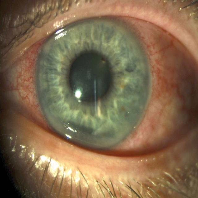 eyes Object Detection Model by yi