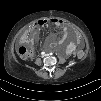 test Object Detection Model by KyungHee university