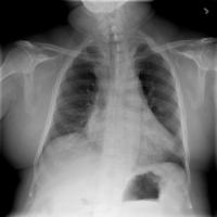 Roboflow 100-VL (rf100-vl) - Roboflow Universe