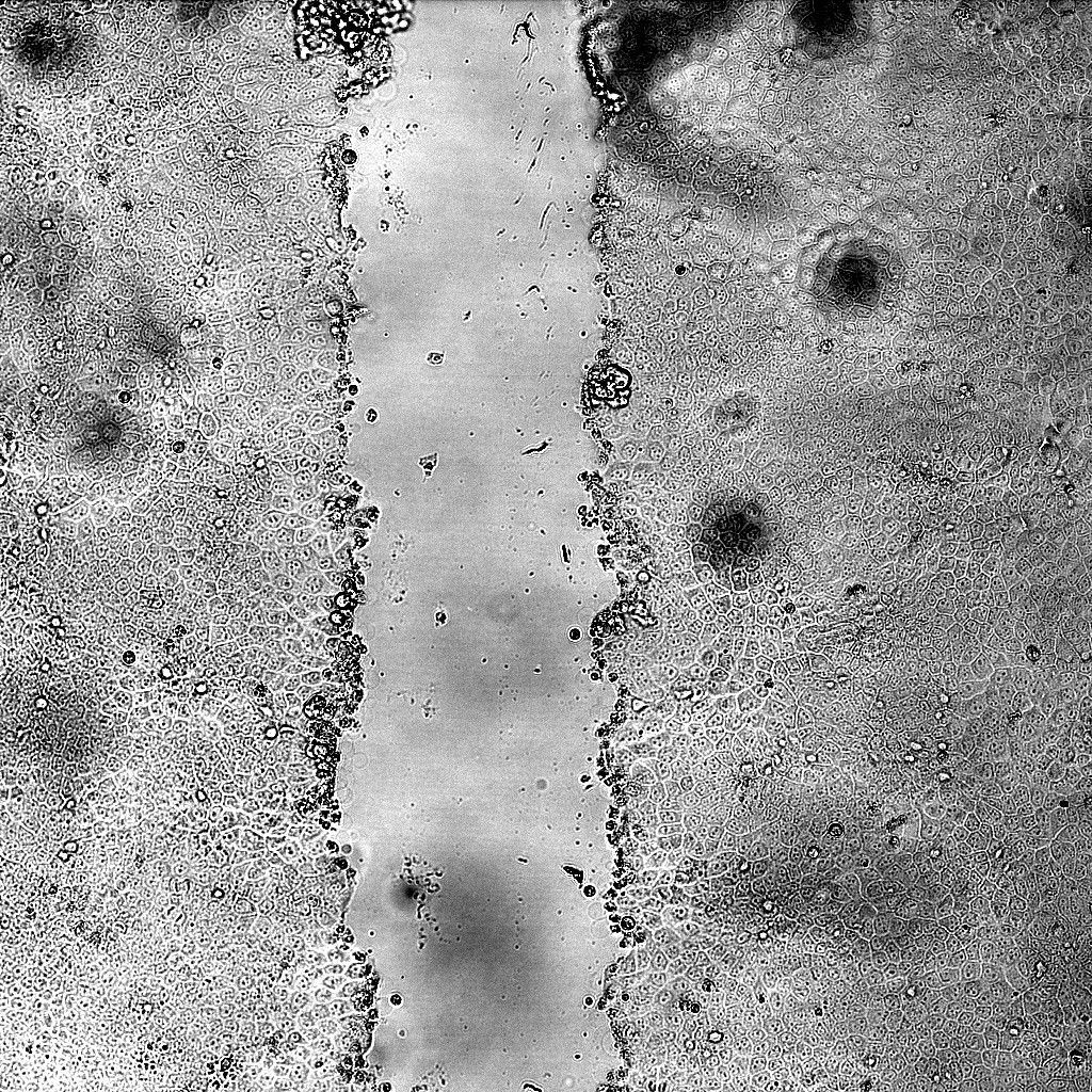 Wound healing assay Instance Segmentation Model by Heridas