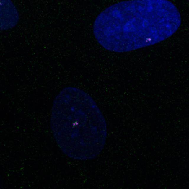 Example (example-ko5i6) - Roboflow Universe