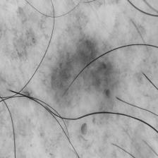 Cancer Detection Object Detection Dataset by Amala02