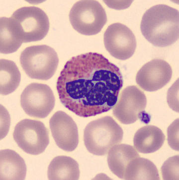 Blood Smear Object Detection Model by Project Blood Smear