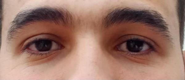 open and closed eyes Object Detection Dataset by eyes