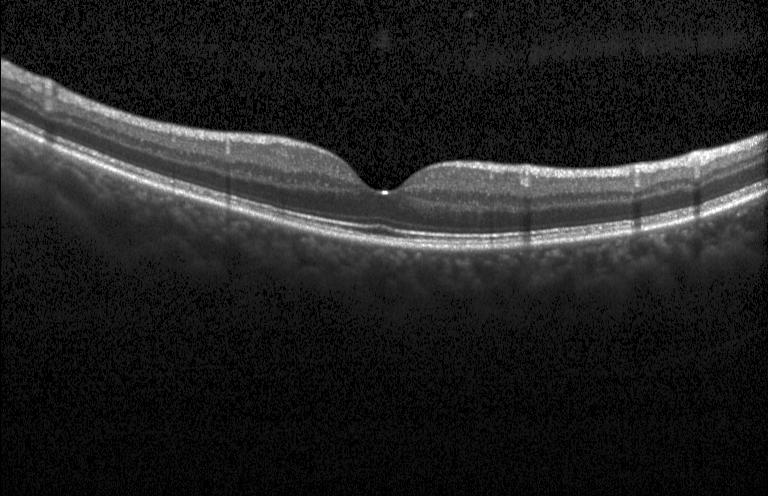 YoLo8 Object Detection Model by school