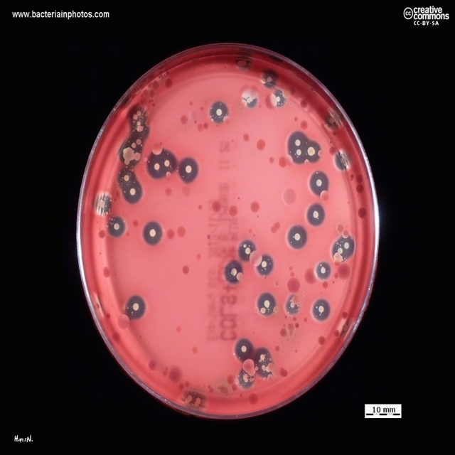 streptococcus pyogenes Object Detection Model by microAItron