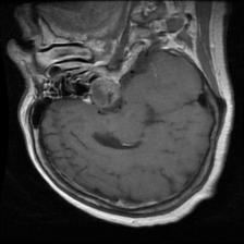 crystal-clean-brain-tumors-mri-dataset-p9dg8-fsod-nnyh Object Detection ...