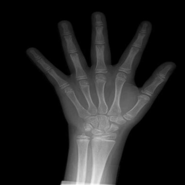 X Ray Id Fsod Supx Object Detection Dataset By Rf100vltemp