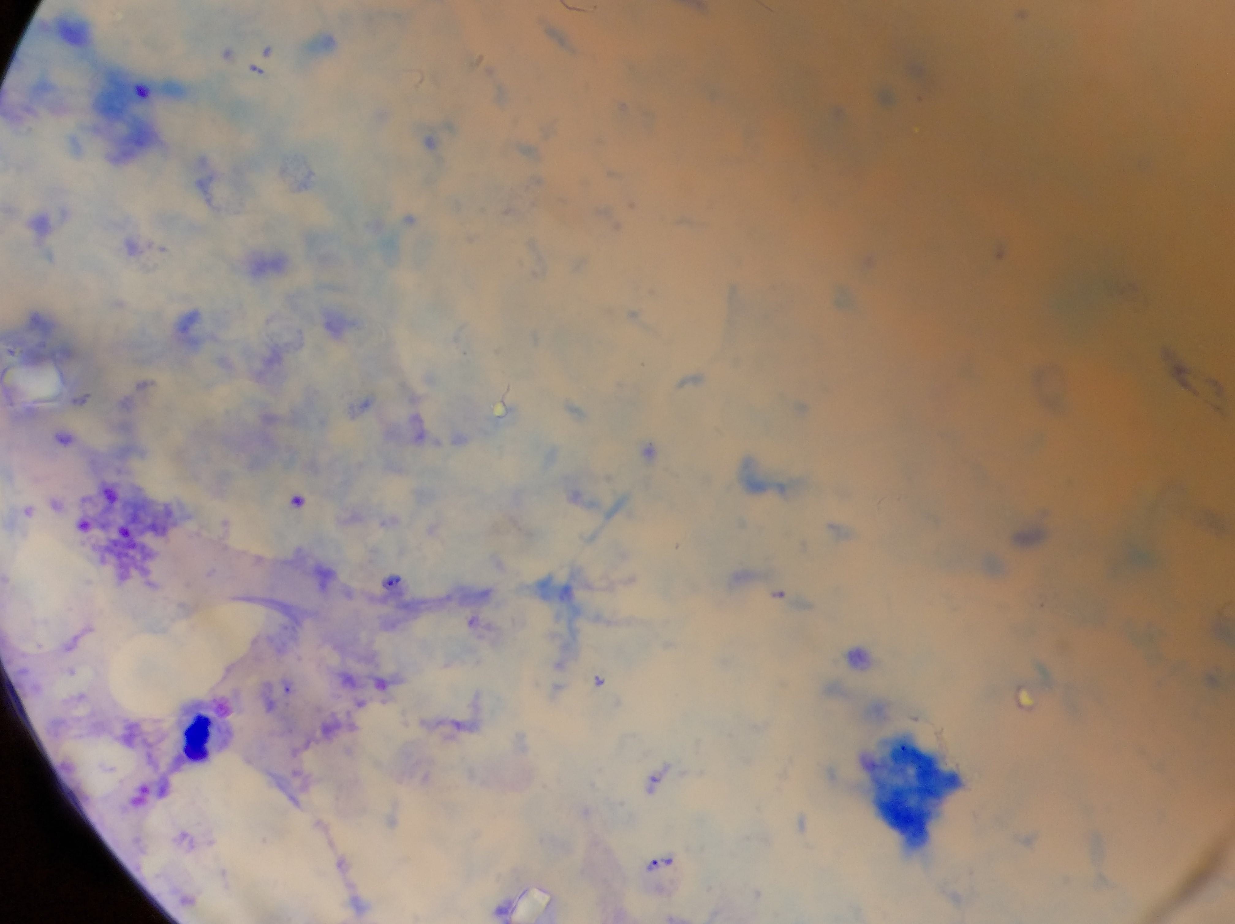 Malaria Detection Object Detection Dataset By Mlwork