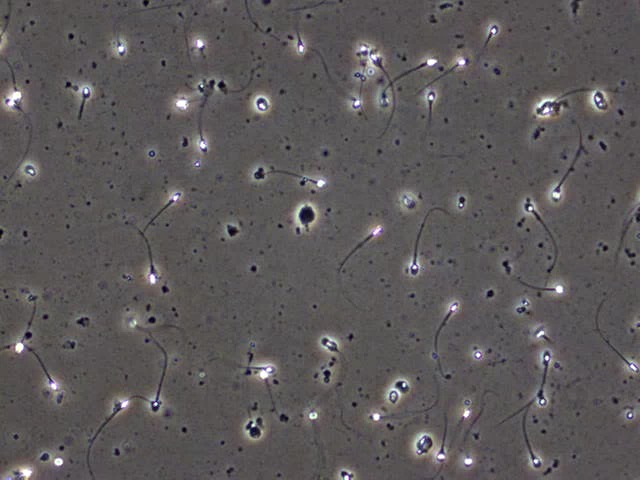 Sperm Object Detection Model by Prueba