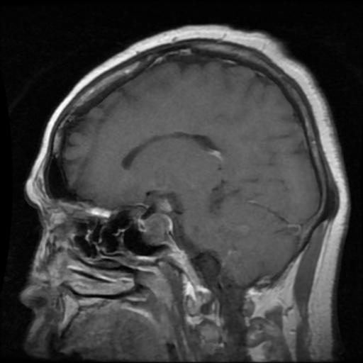 crystal-clean-brain-tumors-mri-dataset-pg5db-ss-ovup Object Detection ...