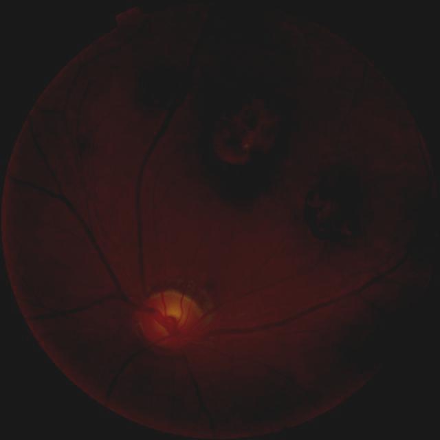 Dr Detection 3 Classification Dataset By Dr