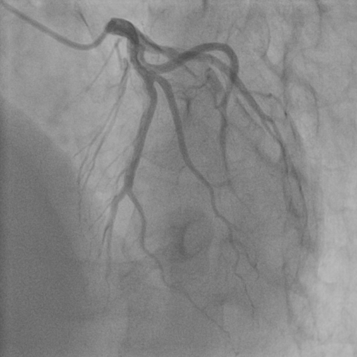 tip Object Detection Dataset by tip