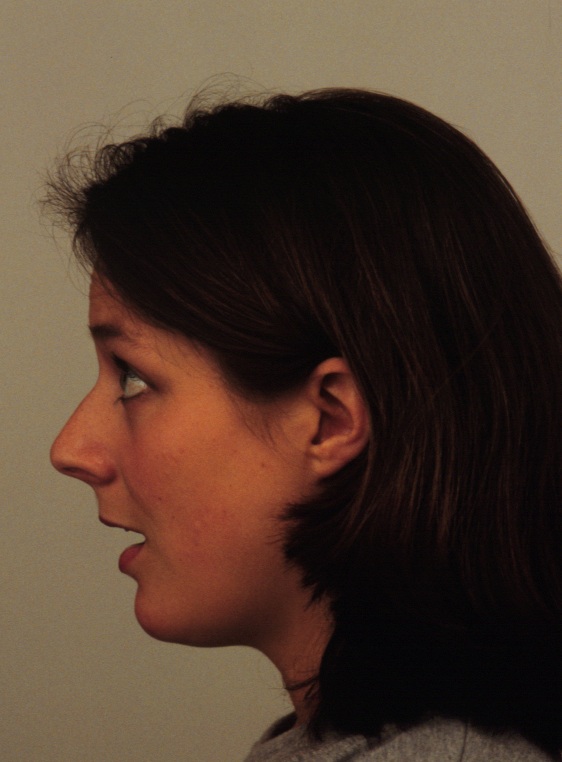 Emotion Detection 2 Object Detection Dataset By Laboratorio