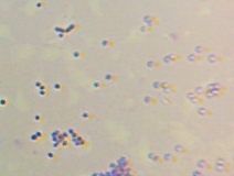 Two Combination (Nicolle) Object Detection Model by Bacteria