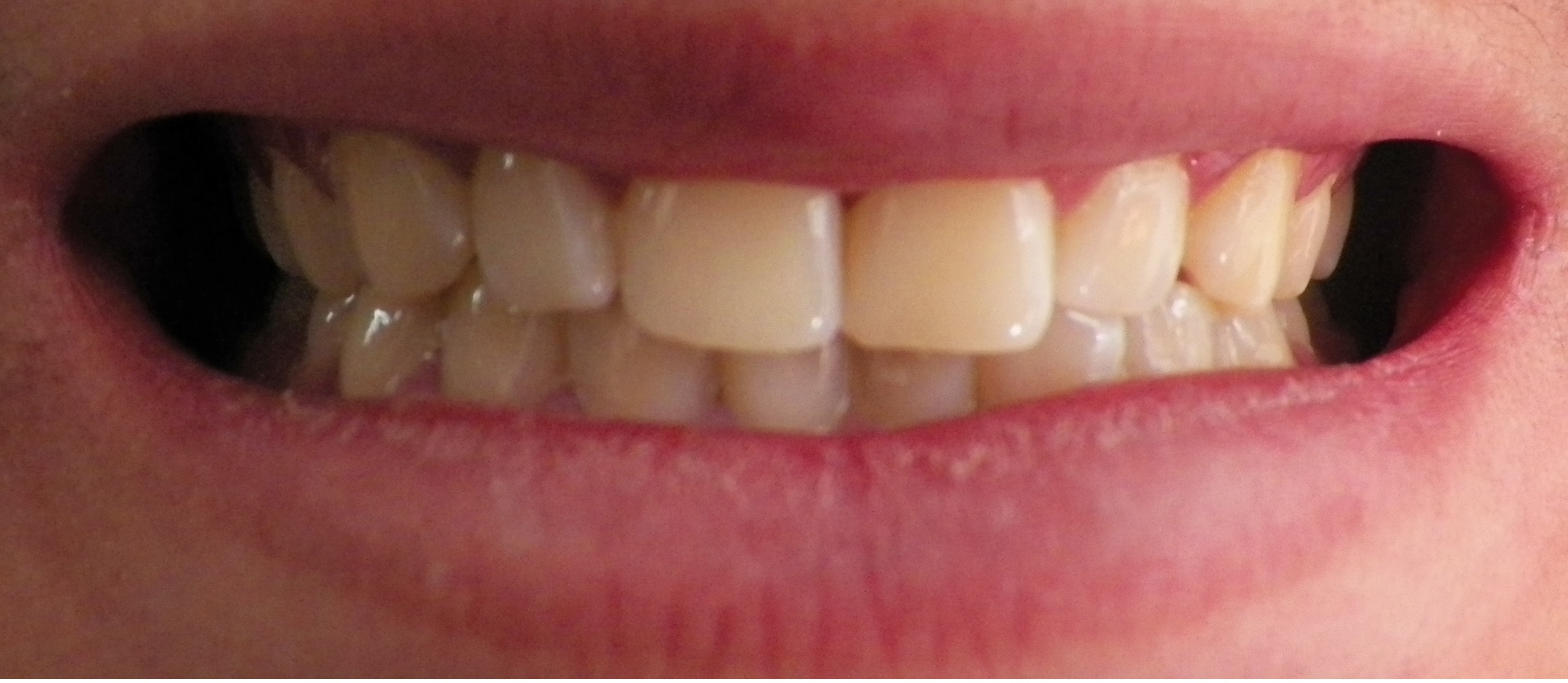 Dragulin Bogdan (dragulin-bogdan-ijoyf) - Roboflow Universe