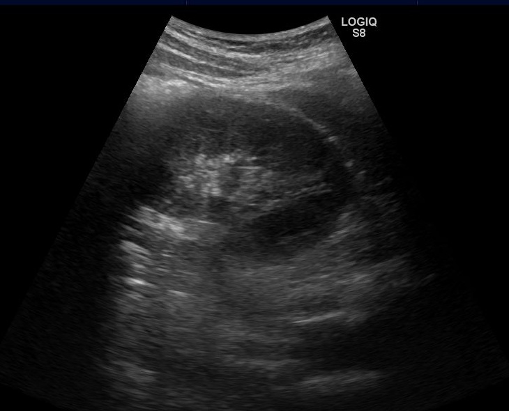 kidney Instance Segmentation Dataset by Arashi