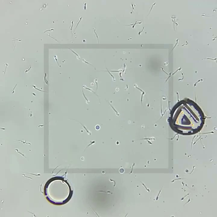 sperm_sp Object Detection Dataset and Pre-Trained Model by Ayu