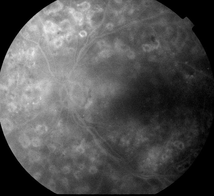 Diseas Detection Object Detection Model By Zinabs Workspace