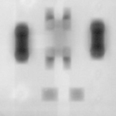 Roboflow SMT-Res Augmented Dataset Object Detection Model by FYP