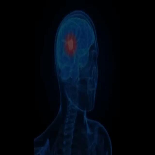 tumor detector 2 Object Detection Model by jayden toh