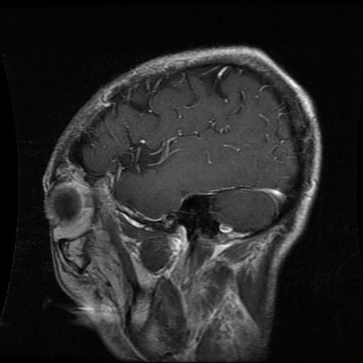 CentAI Machine Learning - Roboflow Universe